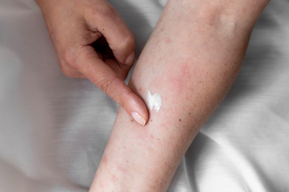 Virginia Burn Injury Lawyer | Tronfeld West & Durrett